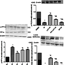 The expression of p-PP1a, p-PLB and SERCA2a.