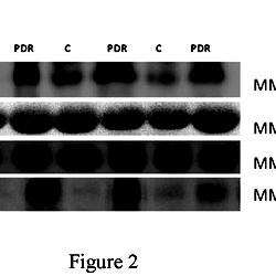 Representative Western blot analysis of matrix metalloproteinase-1 (MMP ...