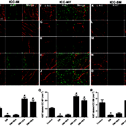 Confocal images of ICC labeled with c-kit (red) and Ki67 (green).