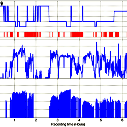 Example of whole-night snore index and snore intensity.