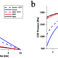 Comparing CSF pressure and ventricular displacement alleviation via ETV ...