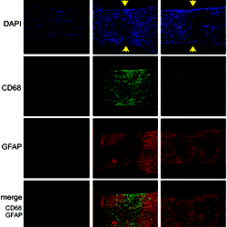 Immunohistochemistry for CD68 and GFAP expression in the crushed optic ...
