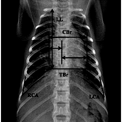 Normal Posteroanterior Thoracic Radiograph of the Cynomolgus Monkey.