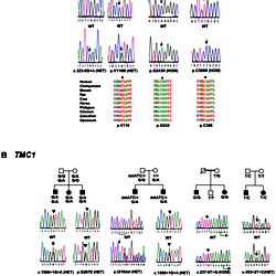 Analysis of segregation and conservation of novel variants in TMPRSS3 ...
