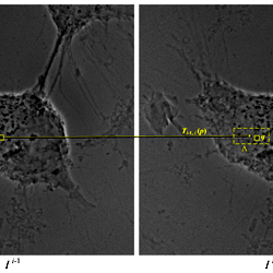 The feature tracking between two X-ray projection images Ii−1 and Ii.