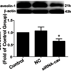 The siRNA of caveolin-1 suppressed the expression of caveolin-1 in HAFs.