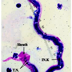 Microfilaria of B. malayi.