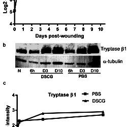 Tryptase β1 expression in skin wounds.