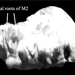 Buccal view of WIHG WIF/A 1099, composite CT image.