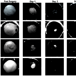 Visual progression of corneal wound closure using Fluress ophthalmic ...