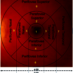 Retinal zones recommended by ETDRS.