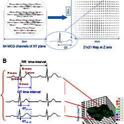 Construction of a QTc contour map from magnetocardiography (MCG).
