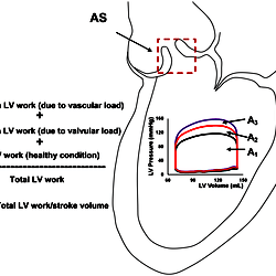 Schematic diagram.
