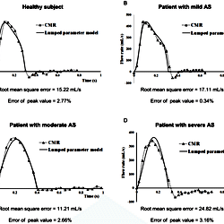Comparison of simulated and CMR flow waveforms.