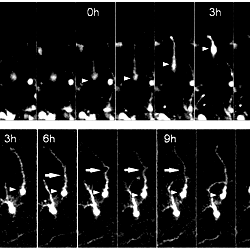 The sequential morphological changes in a leading process.