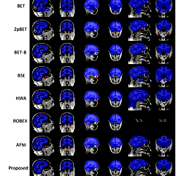 Typical brain extraction results for different methods.