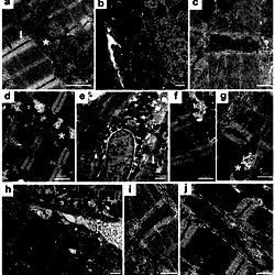 The ultrastructure of zebrafish hearts shown by transmission electron ...