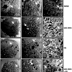 TEM analysis of subcellular structures in both intact and 3 x 1s ...