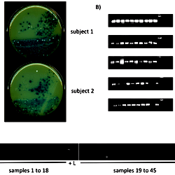 H2O2 production and spxB presence in plaque samples.