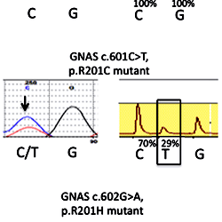 GNAS Codon 201 Mutations.