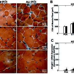 MuRF1 expression is necessary for limb and larygeal myofiber atrophy in ...
