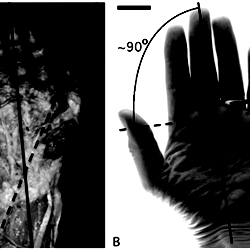 Nail-pulp and medial axes’ angle comparison.