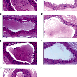 Pathological morphology comparison.