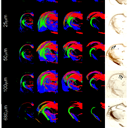 DTI, fiber tractography and histopathology.