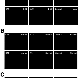 Comparison of CT1 and CT2 immunostaining in DMD and normal human muscle.