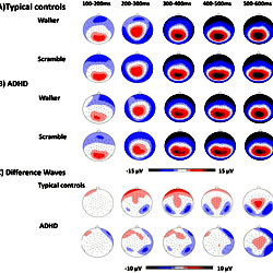 Topographic scalp maps.