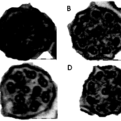 Representative TEM images: a) normal, b) outer and inner dynein arm ...