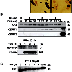 Regulation of mitochondrial kinase expression during HL-60 cell ...