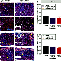 Collagen deposition in tissue sections.