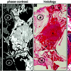 Attenuation, phase-contrast, and histology images of sample 1.