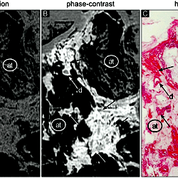 Attenuation, phase-contrast, and histology images of sample 2.