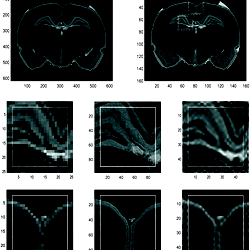 Reconstruction of the low resolution MRI image by the global method.