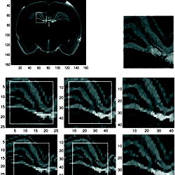 Reconstruction of the sample region 1 of the low resolution MRI image ...