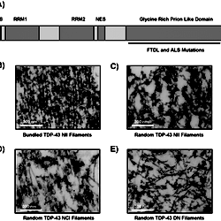 Structure of TDP-43 Protein and FTLD Inclusions.