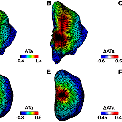 Endocardial ATa maps.