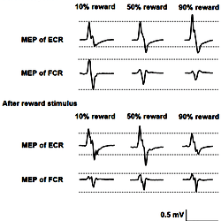 Electromyography traces of the right FCR and ECR muscles in one ...