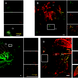 Colocalization of RSV and vitellogenin in Laodelphax striatellus ovaries.