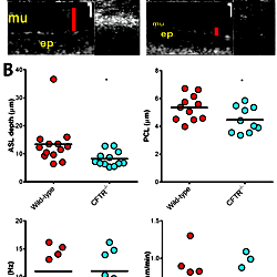 Functional anatomy of rat trachea.