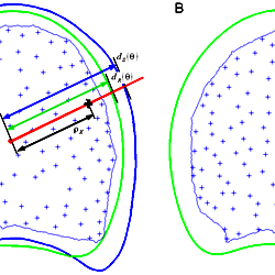 Spatial normalisation of an individual section onto the reference section.