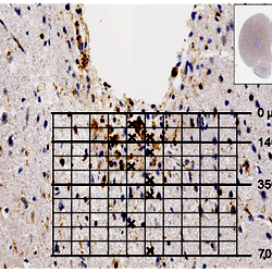 Schematic representation of quantification pattern.