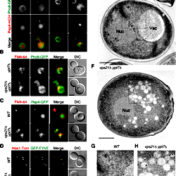 Convergence of the CPY pathway with the AP-3 pathway in vps21Δ ypt7Δ cells.