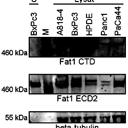 Western blotting indicates the two known forms of Fat1 and a new ...