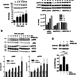 TNFα promotes increased MAP4K4 protein expression through the JNK pathway.