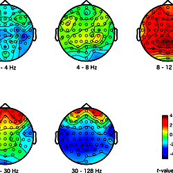 Maps of the difference between a sad response and the other emotional ...