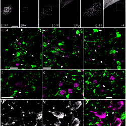 Double-immunofluorescence photo and confocal micrographs showing the distribution of EGFP−, ERα− ...