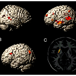 Subsequent Memory Effects.